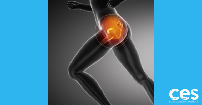 Outer Hip Pain - Core Exercise Solutions